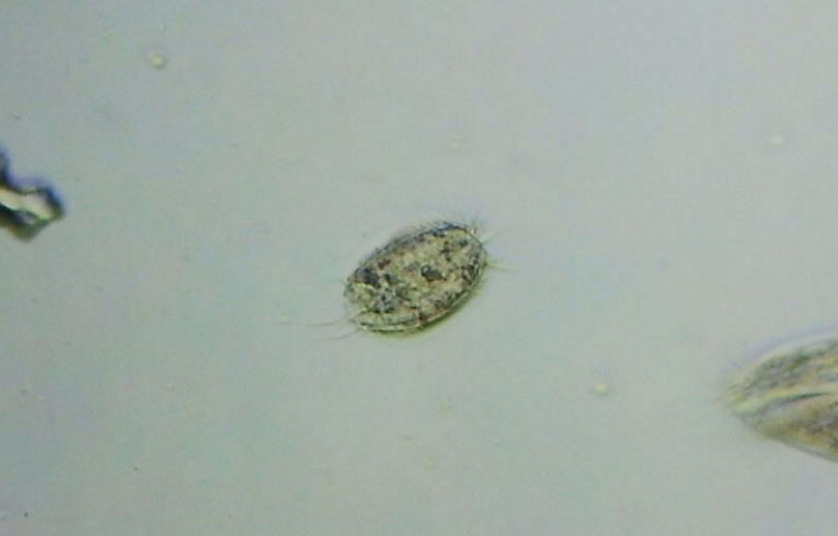 ciliate protozoa
